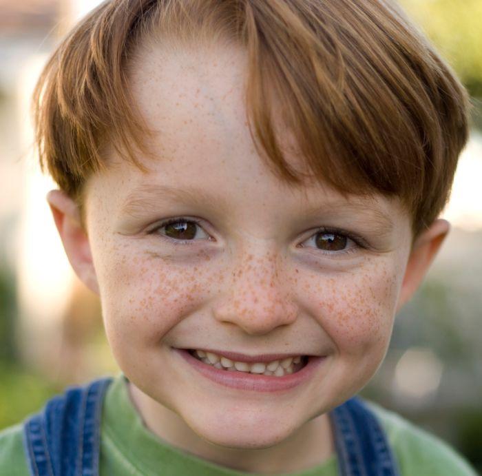 Niños con pecas | Club Familias