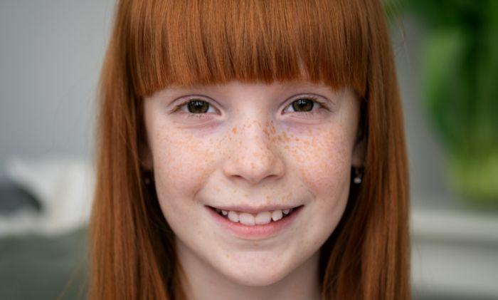 Niños con pecas | Club Familias
